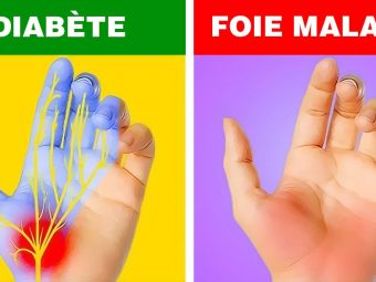 12-raisons-pour-lesquelles-vous-ressentez-des-fourmillements-dans-les ...